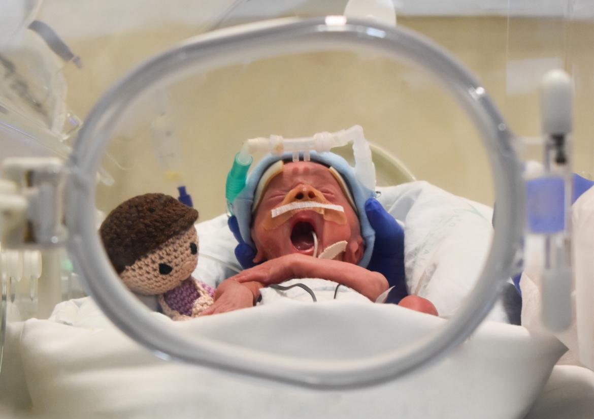 10 leitos de UTI neonatal serão inaugurados nesta segunda no Hospital ...